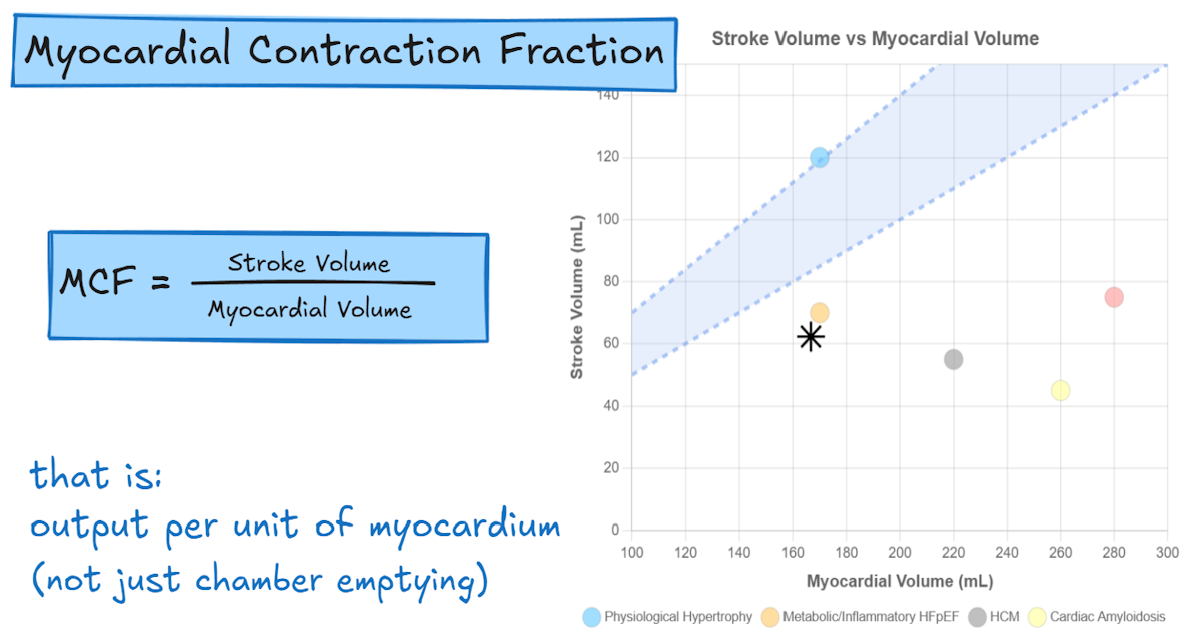 Parameter(z) Echo MCF Calculator (Myocardial Contraction Fraction)